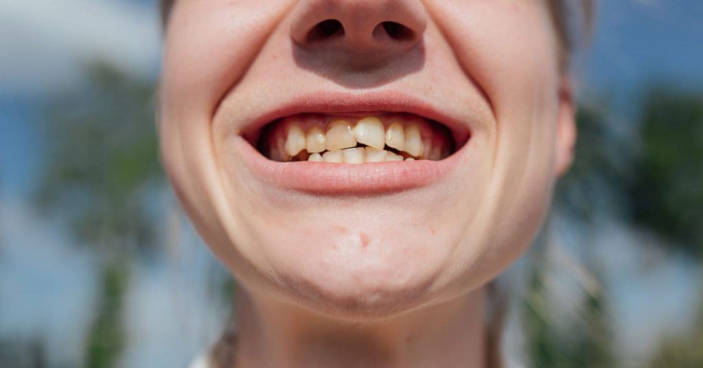 How Long Does It Take For Permanent Teeth To Grow? | Suburban Essex Dental